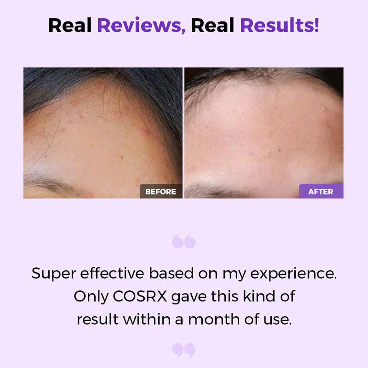 AHA/BHA Clarifying Treatment Toner de COSRX | Skin & Tonic